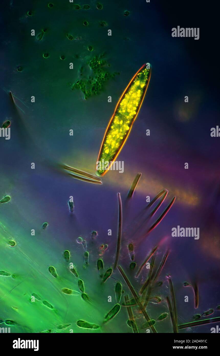 Desmid and red algae. Darkfield illuminated polarised light micrograph ...