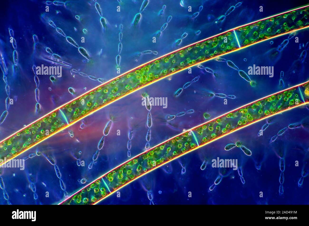 Green and red algae. Darkfield illuminated polarised light micrograph ...