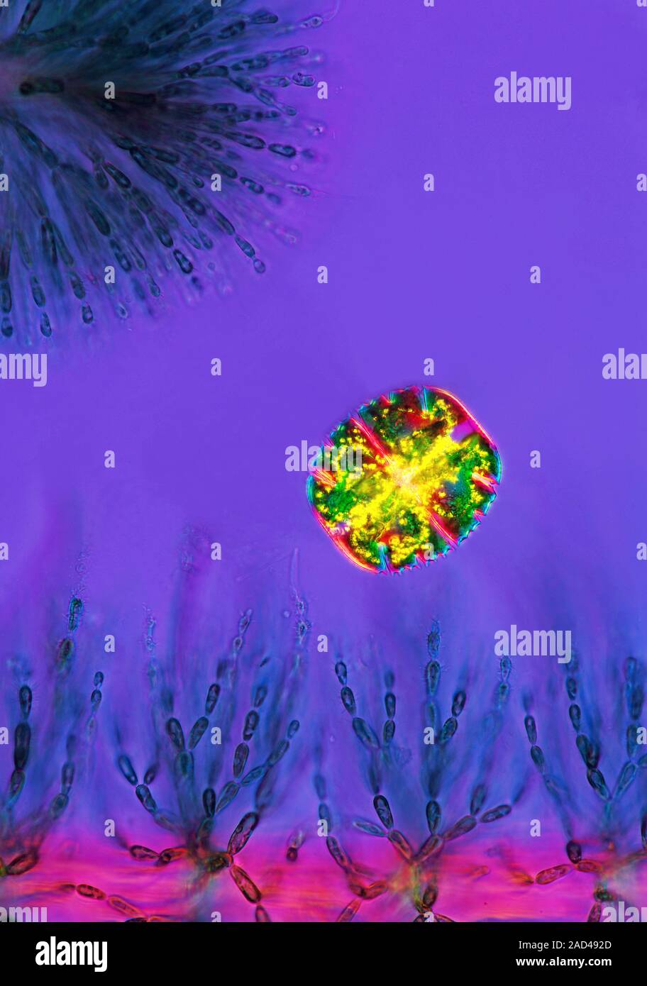 Desmid and red algae. Darkfield illuminated polarised light micrograph ...