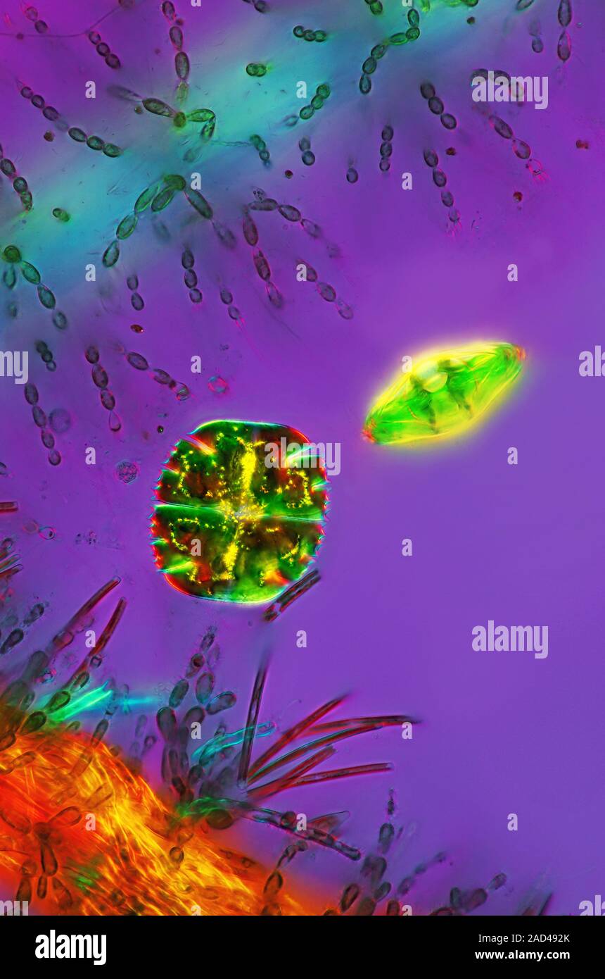 Desmids and red algae. Polarised light micrograph of Micrasterias ...