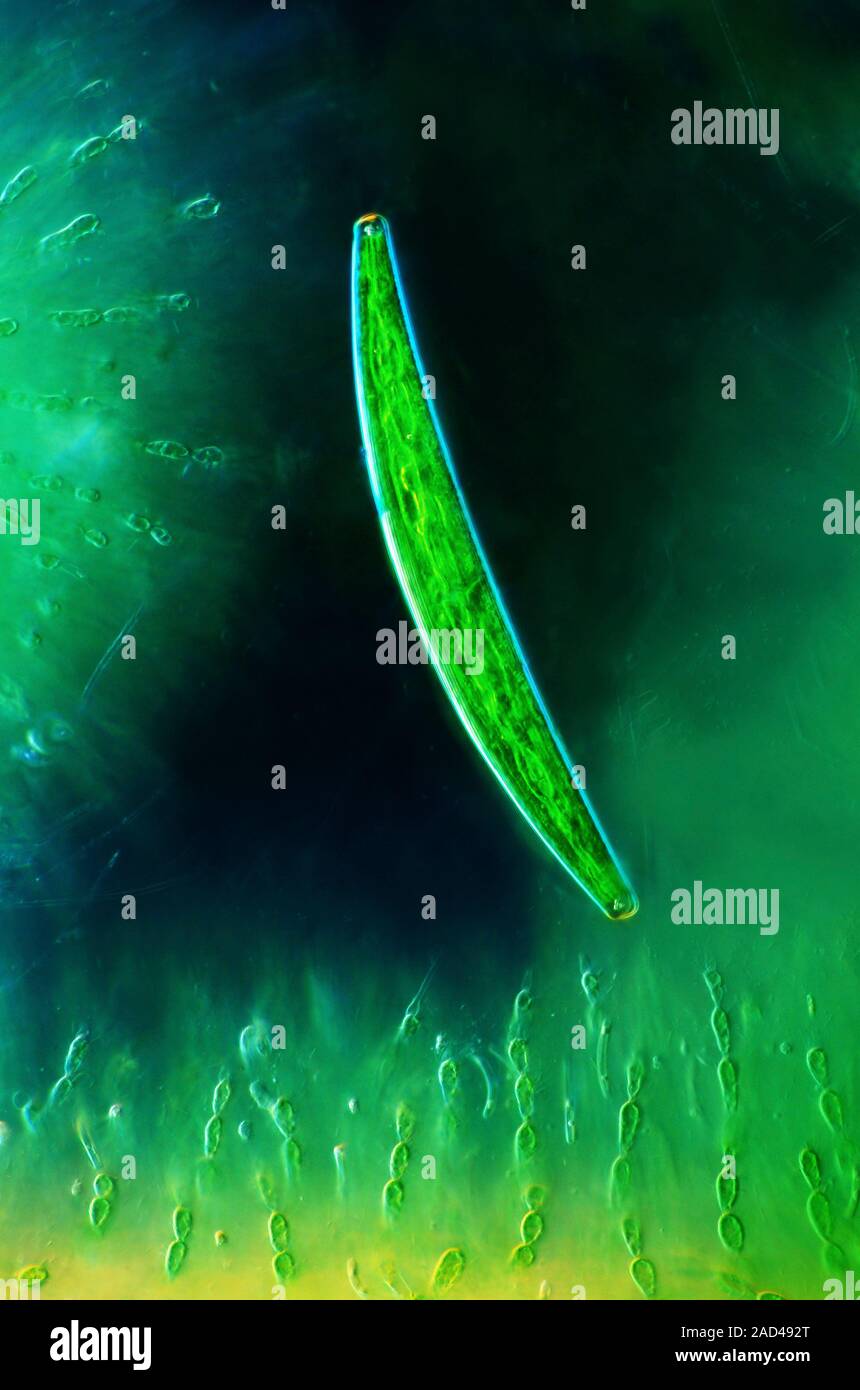 Desmid and red algae. Darkfield illuminated polarised light micrograph ...
