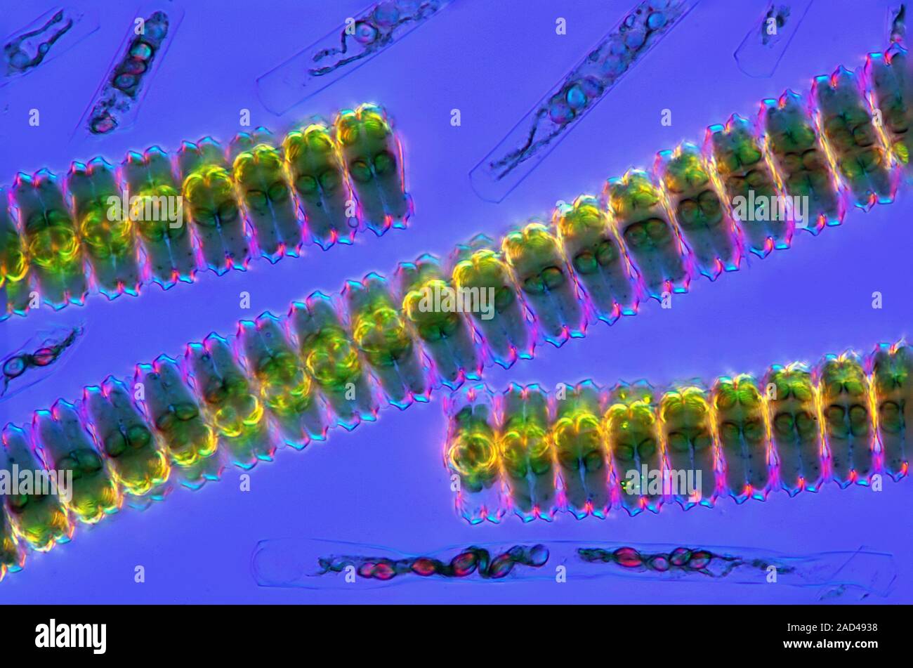 Desmidium desmids. Polarised light micrograph of colonies of Desmidium ...