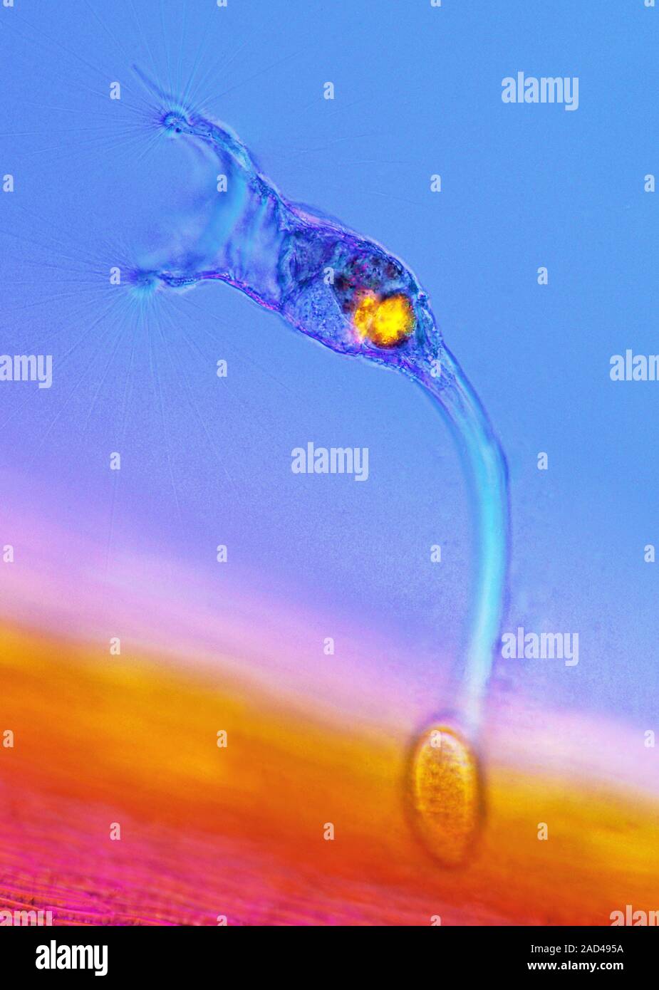 Rotifer. Polarised light micrograph of a Collotheca sp. rotifer ...