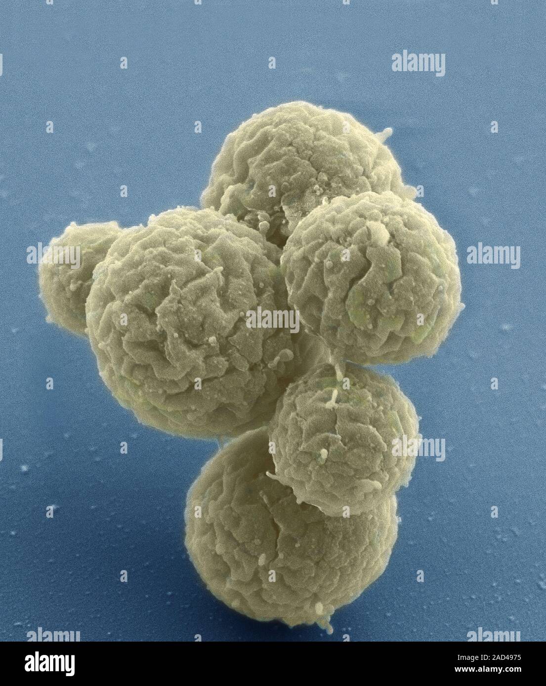 Mycoplasma mycoides JCVI Syn 3.0. Scanning electron micrograph (SEM) of ...