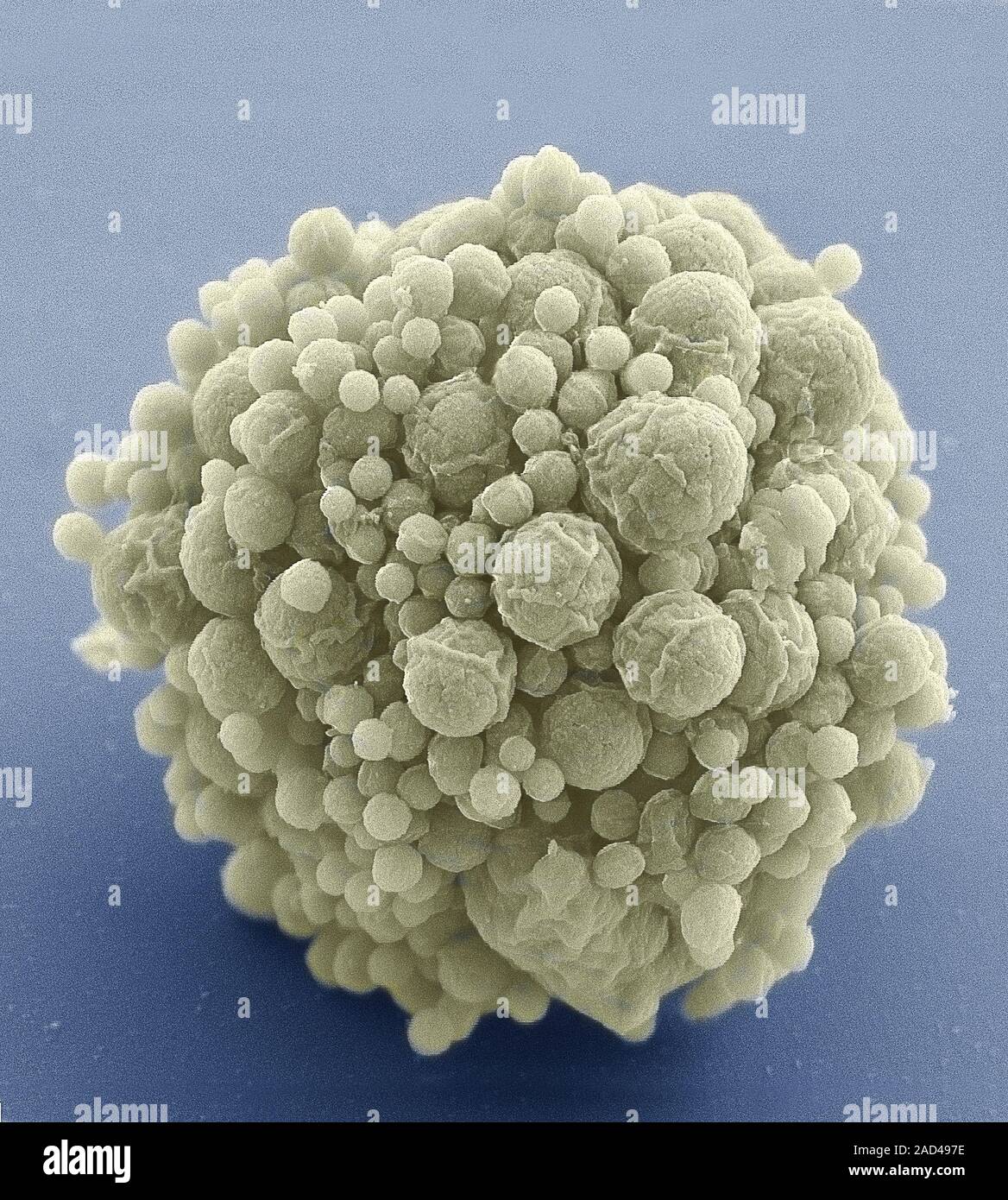 Mycoplasma mycoides JCVI Syn 3.0. Scanning electron micrograph (SEM) of ...