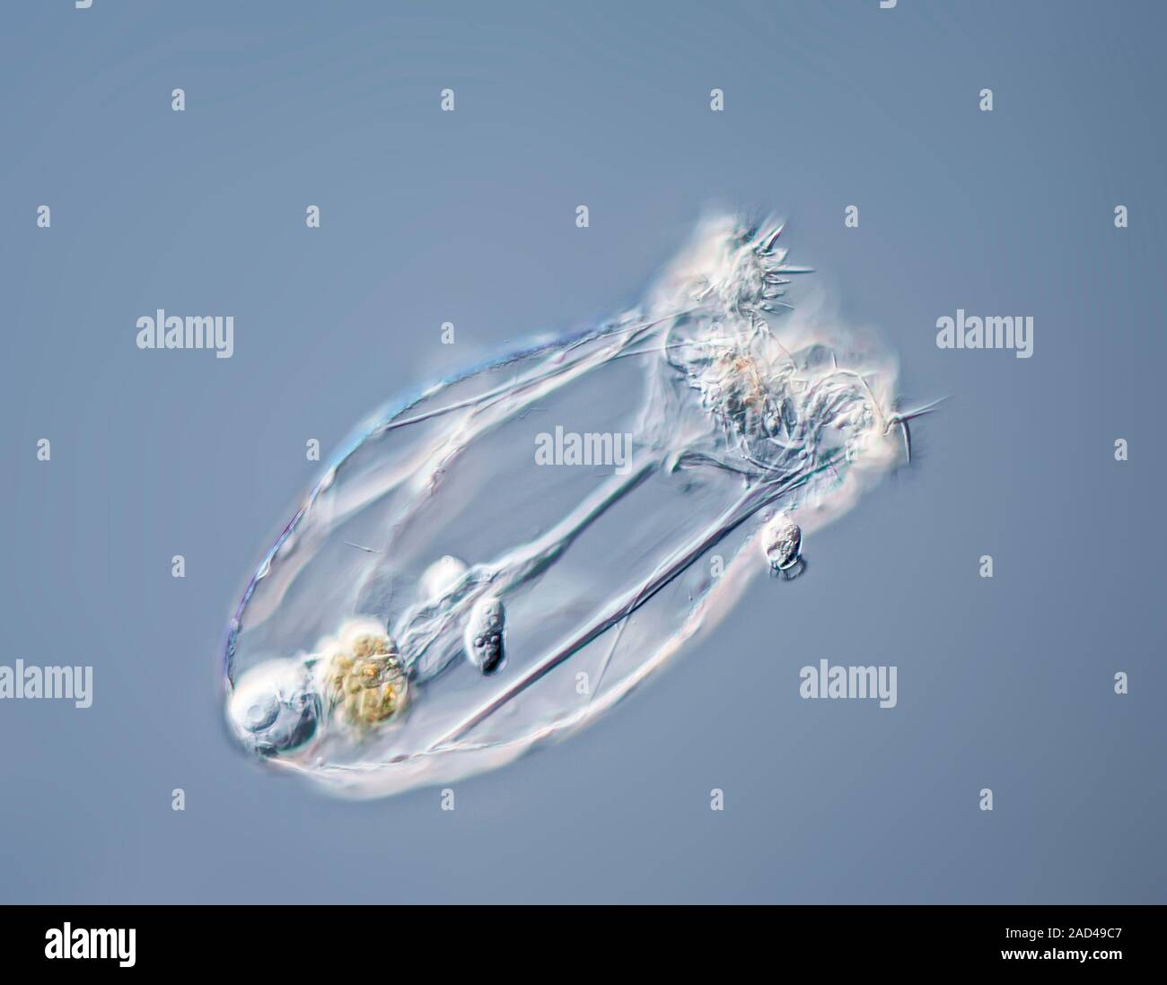 Asplanchna sp. rotifer swimming. Asplanchna rotifers are strong ...