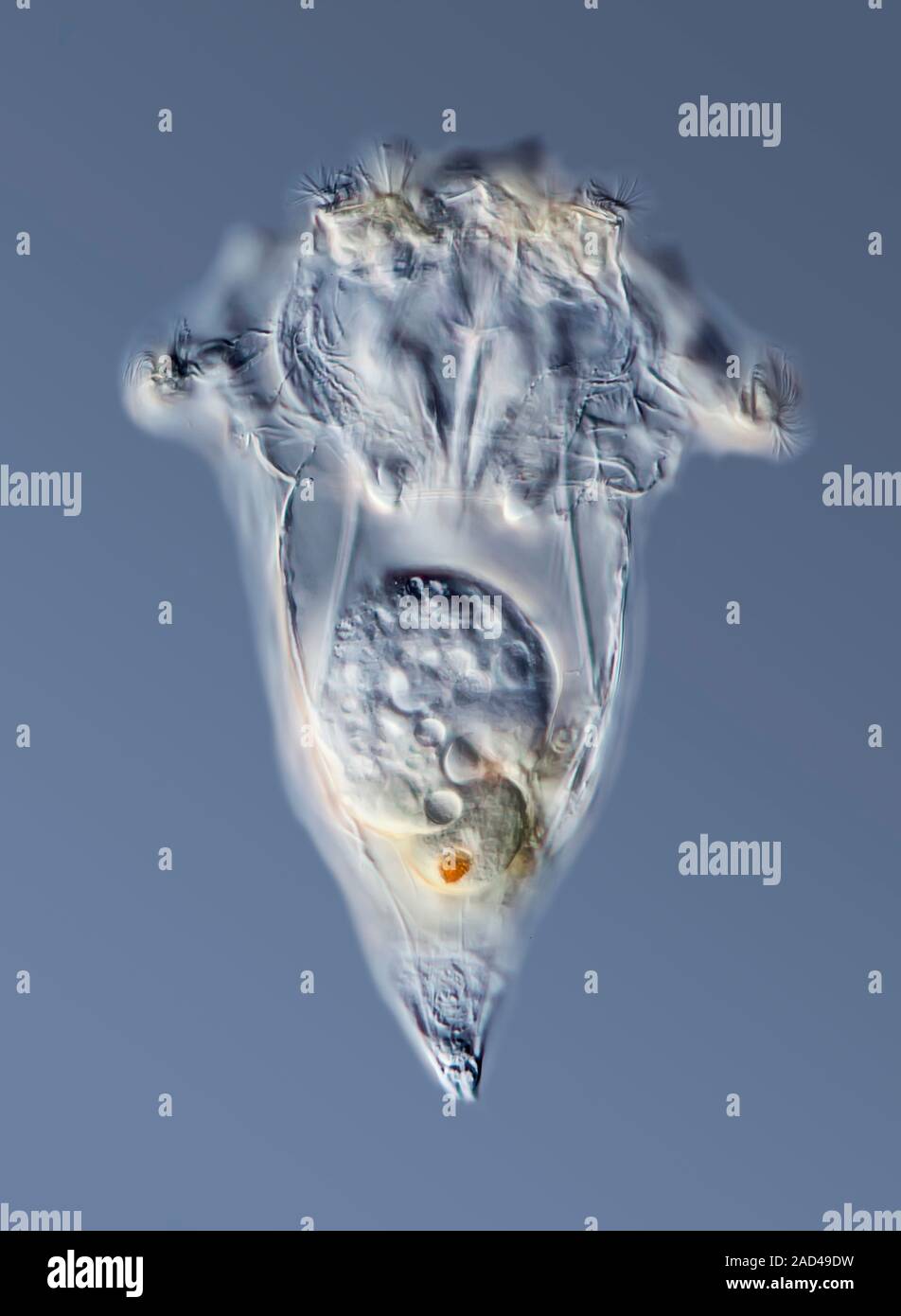 Synchaeta sp. rotifer swimming. Synchaeta is a fast-swimming planktonic ...