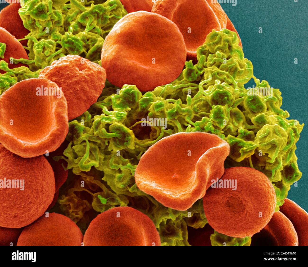 Red blood cells and platelets. Coloured scanning electon micrograph ...