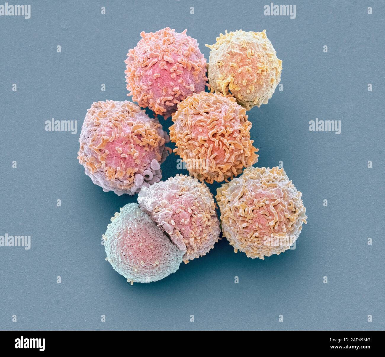 White blood cells (WBCs), Coloured scanning electron micrograph (SEM ...