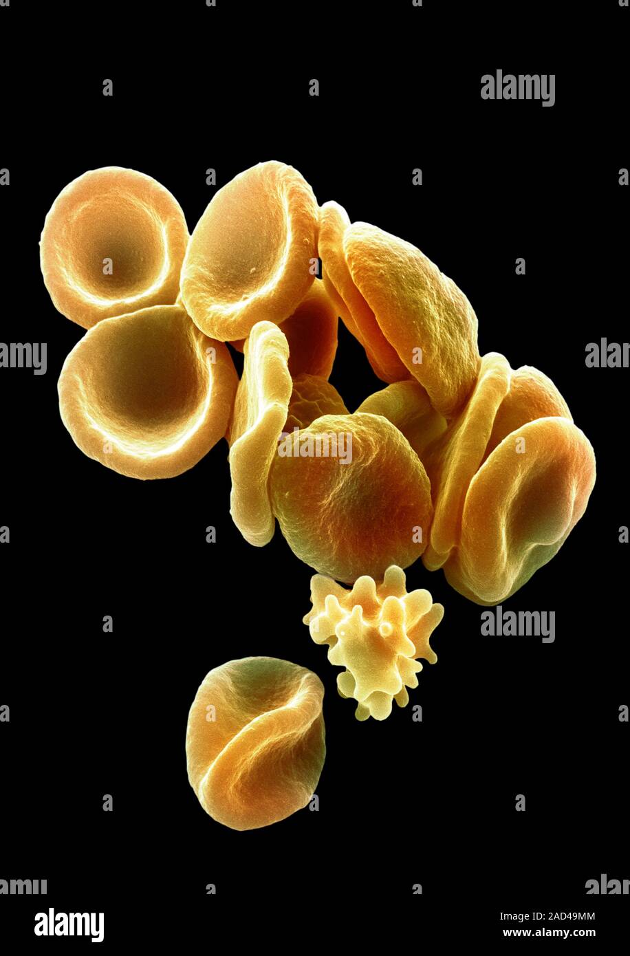 Red blood cells. Coloured scanning electron micrograph (SEM) of red ...
