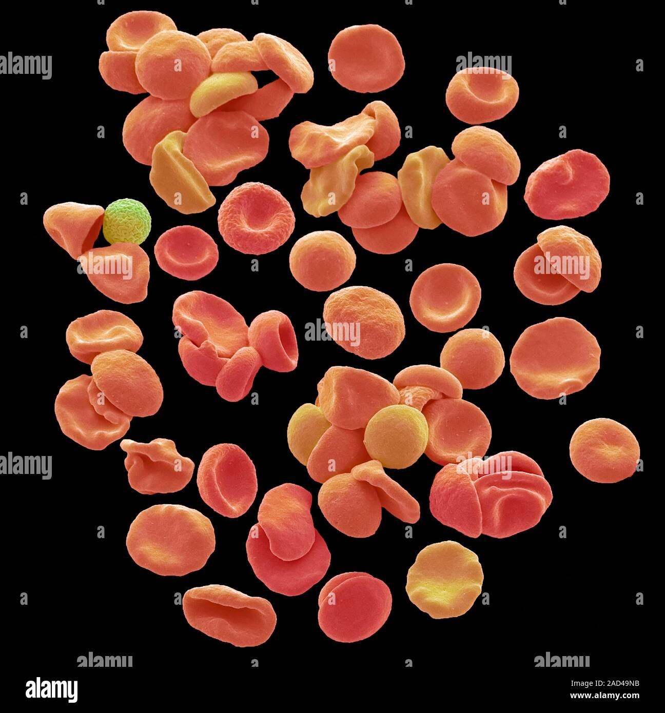 Blood cells. Coloured scanning electron micrograph (SEM) of red blood ...