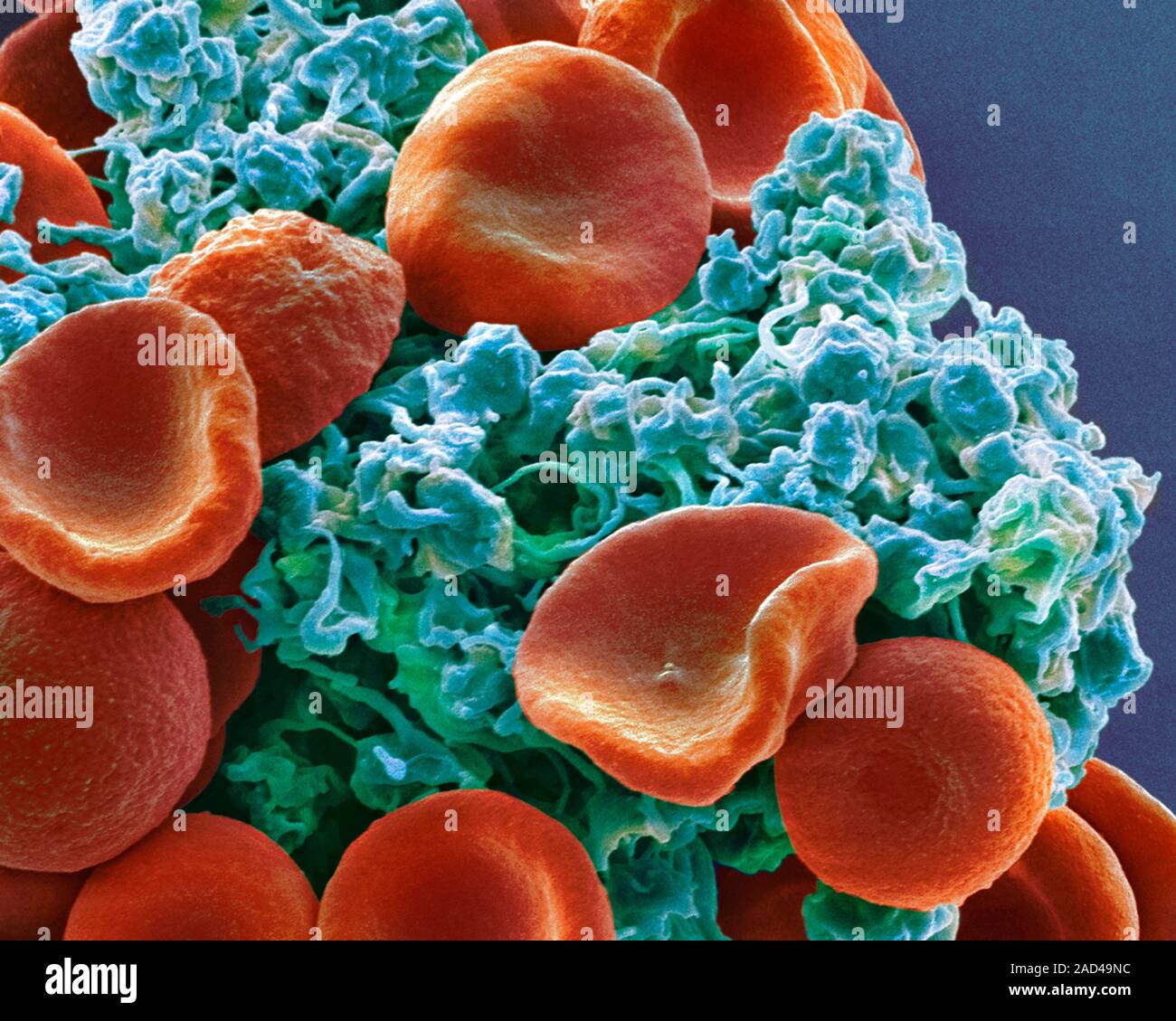 Red blood cells and platelets. Coloured scanning electon micrograph ...