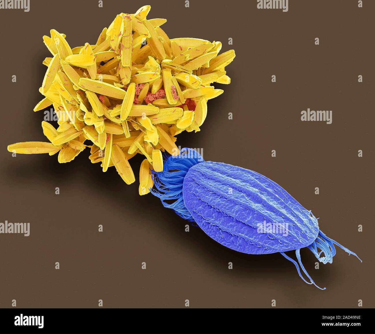 Euplotes protozoan and diatoms. Coloured scanning electron micrograph ...
