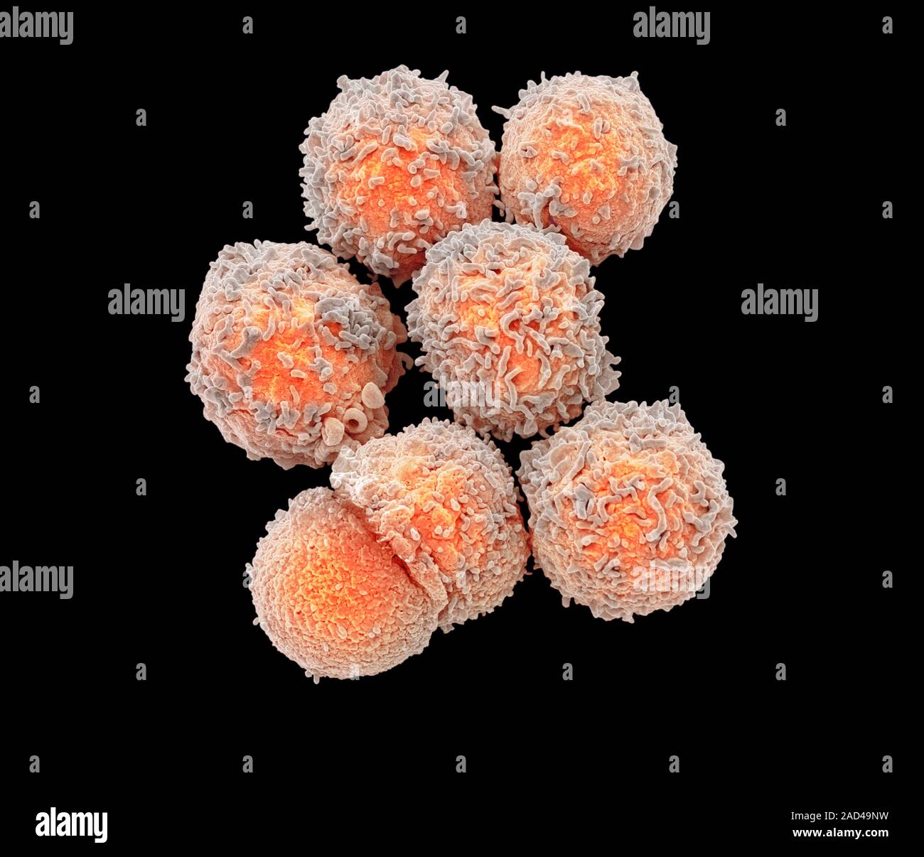 White blood cells (WBCs), Coloured scanning electron micrograph (SEM ...