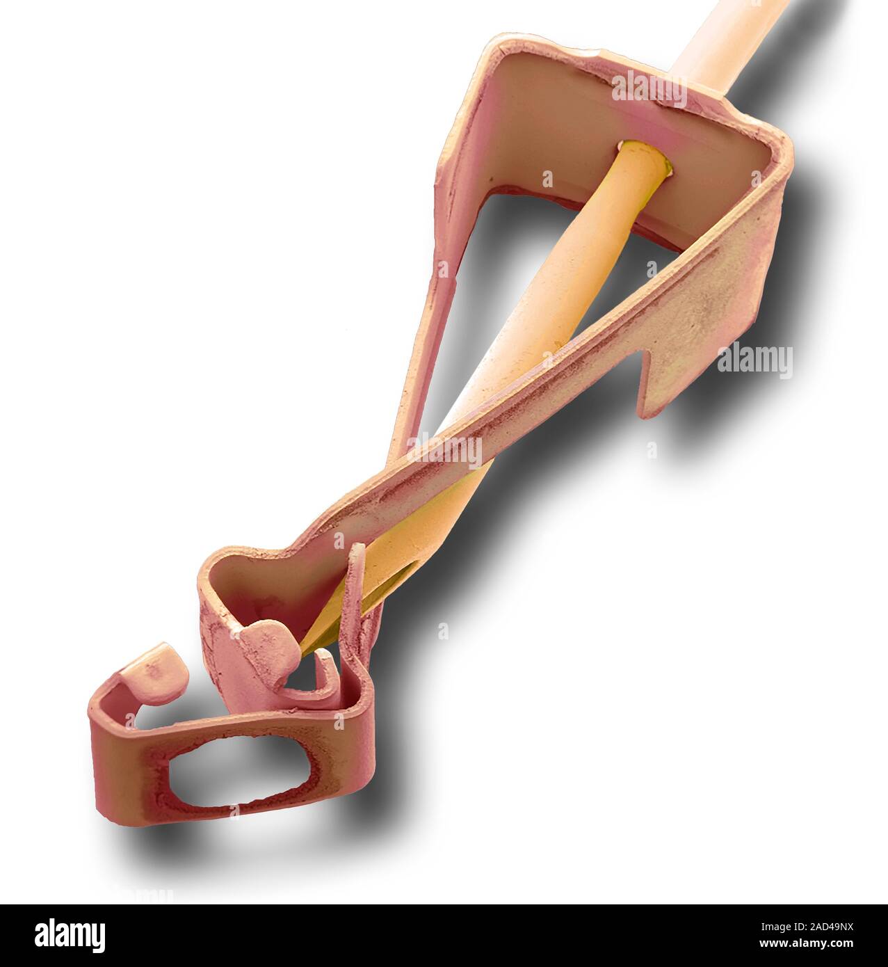 Needlestick safety device. Scanning electron micrograph (SEM) of a ...