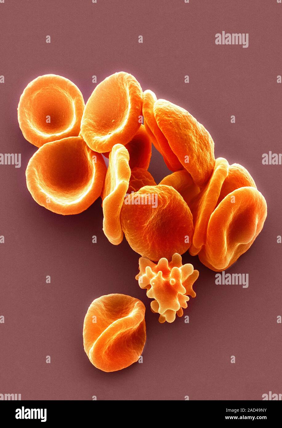 Red blood cells. Coloured scanning electron micrograph (SEM) of red ...