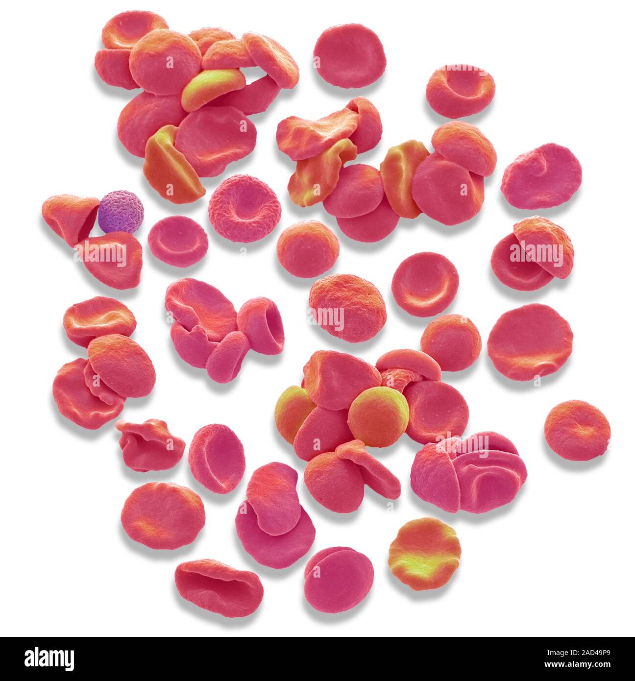 Blood cells. Coloured scanning electron micrograph (SEM) of red blood ...