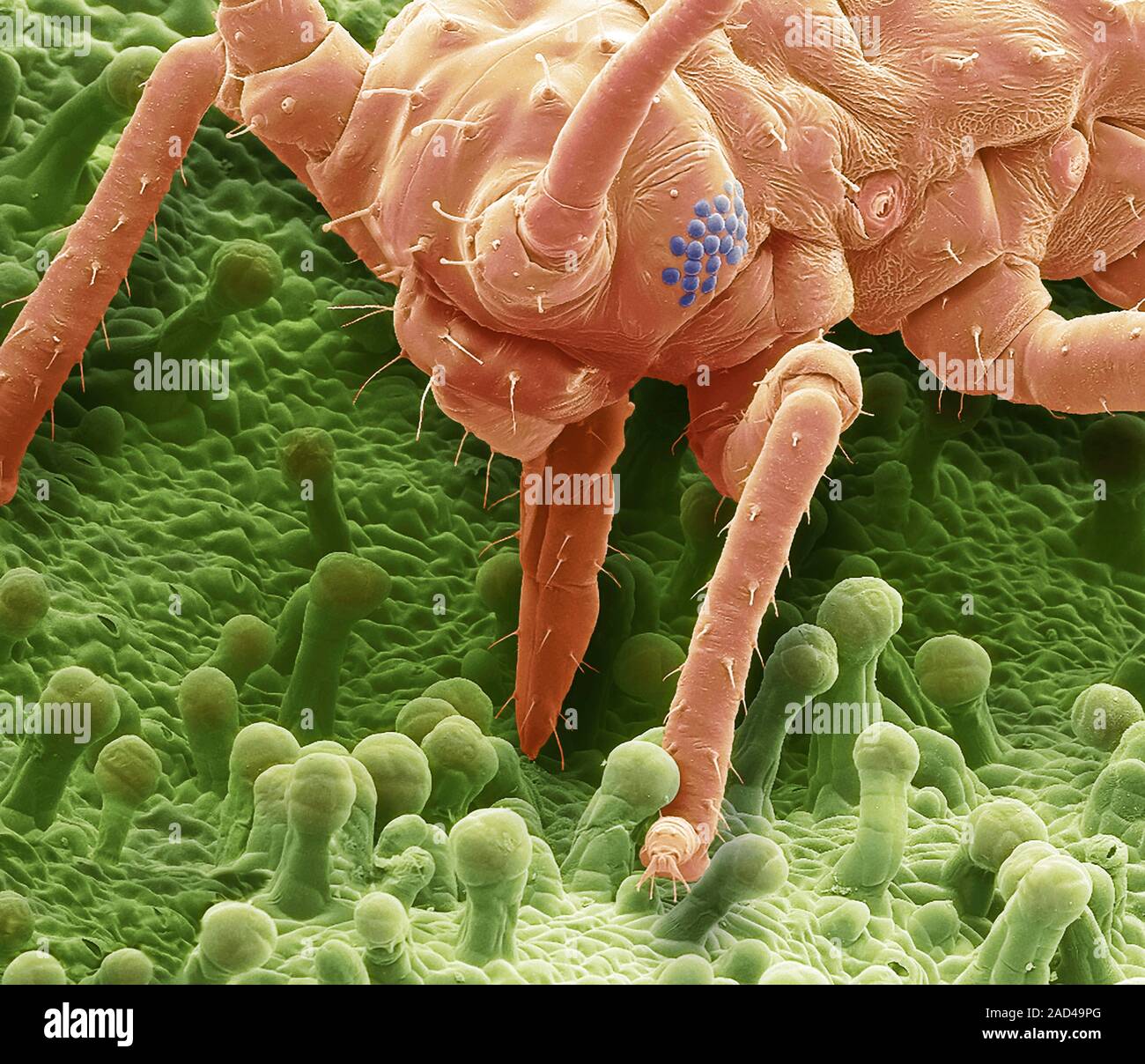 Aphid. Coloured scanning electron micrograph of an aphid, Aphis sp ...