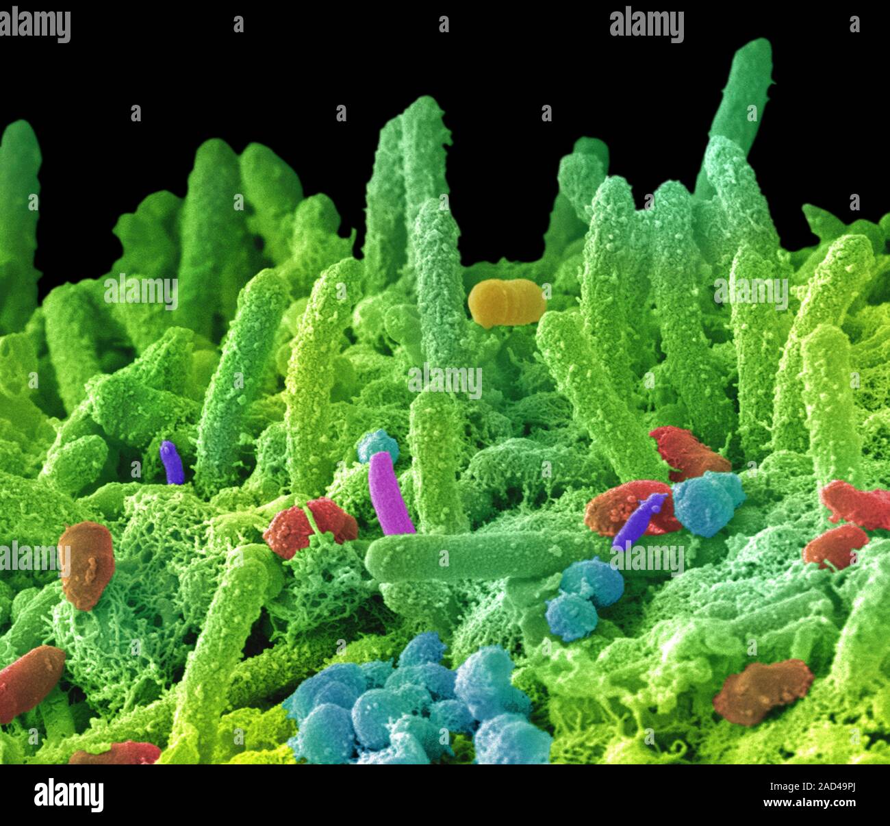 Oral bacteria. Coloured scanning electron micrograph (SEM) of mixed ...