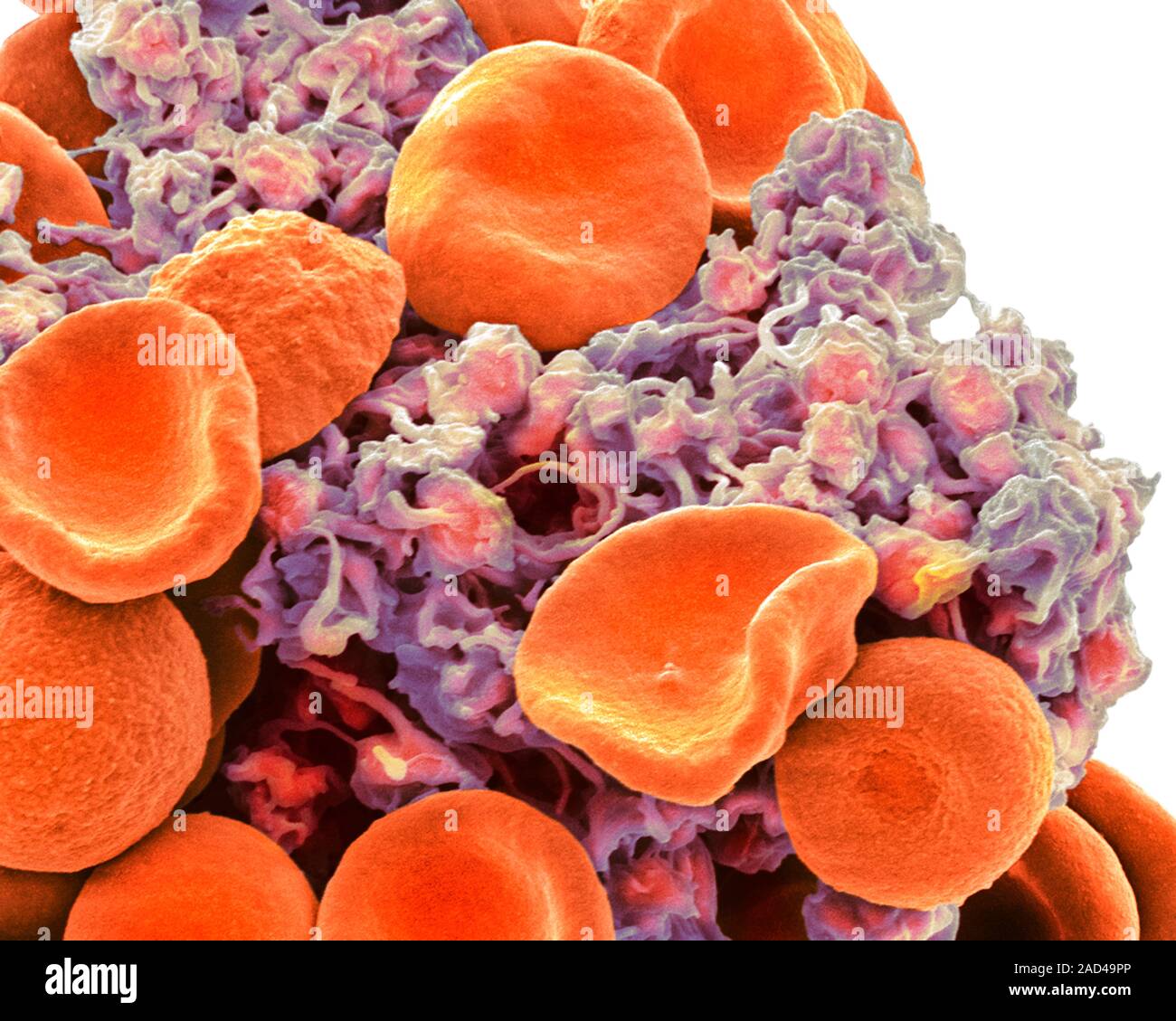 Red blood cells and platelets. Coloured scanning electon micrograph ...