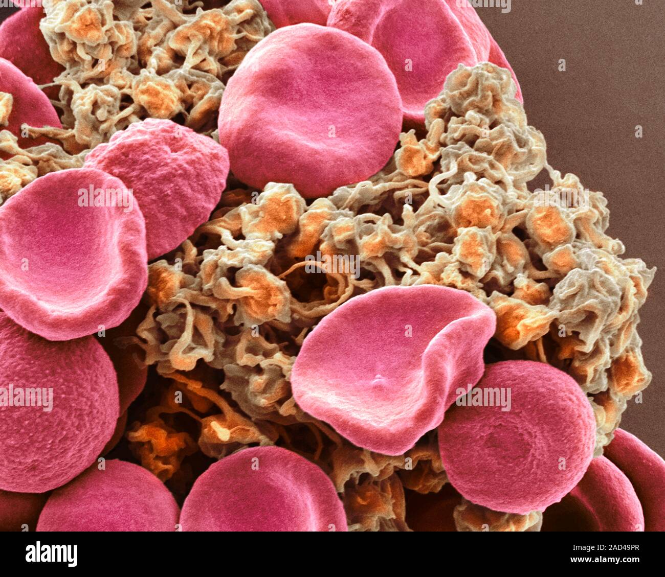 Red blood cells and platelets. Coloured scanning electon micrograph ...