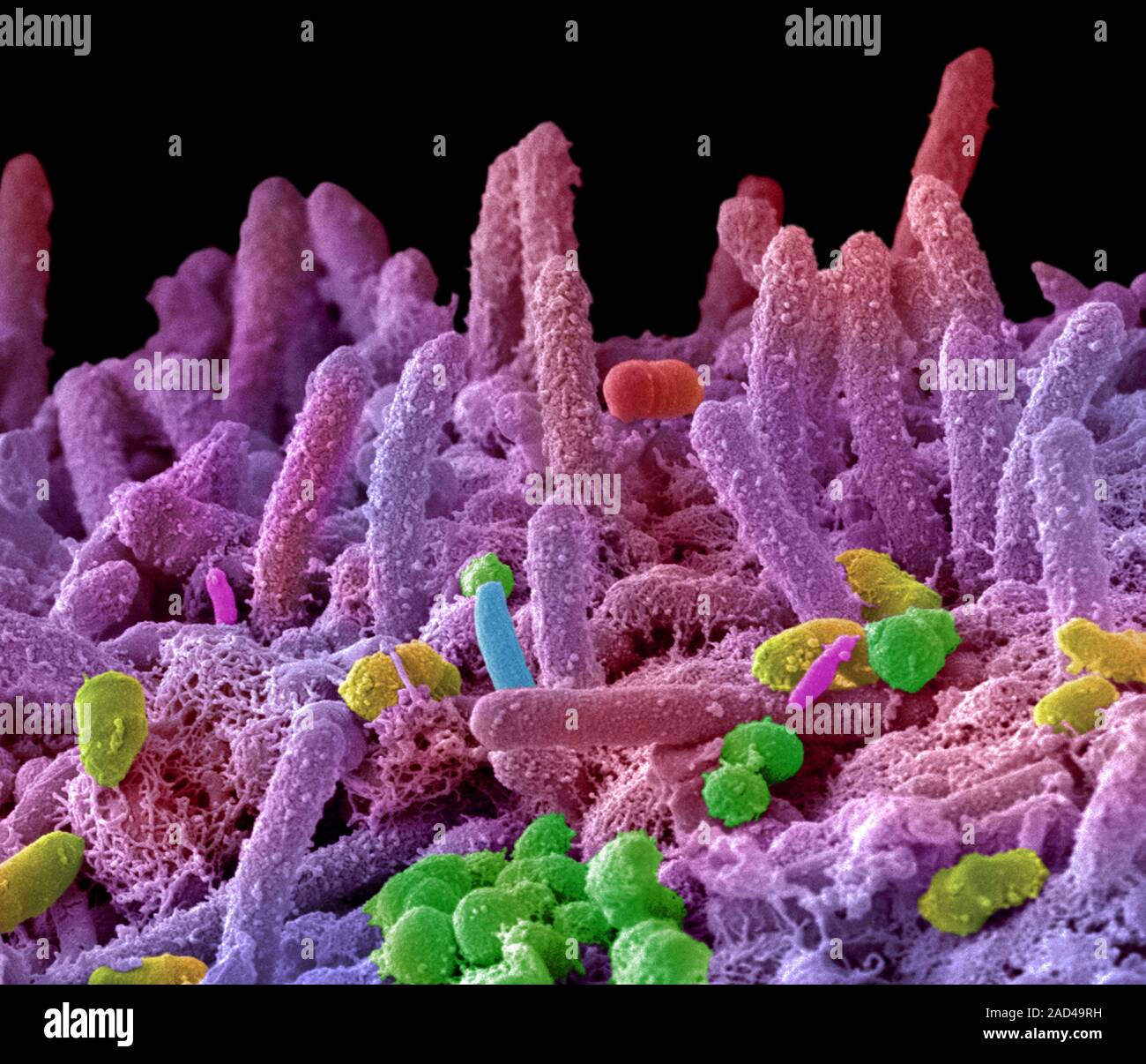 Oral bacteria. Coloured scanning electron micrograph (SEM) of mixed ...
