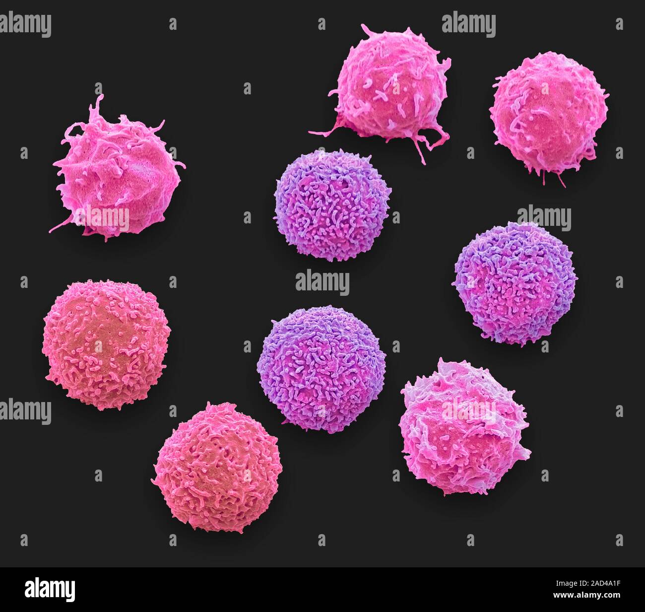 White blood cells (WBCs), Coloured scanning electron micrograph (SEM ...
