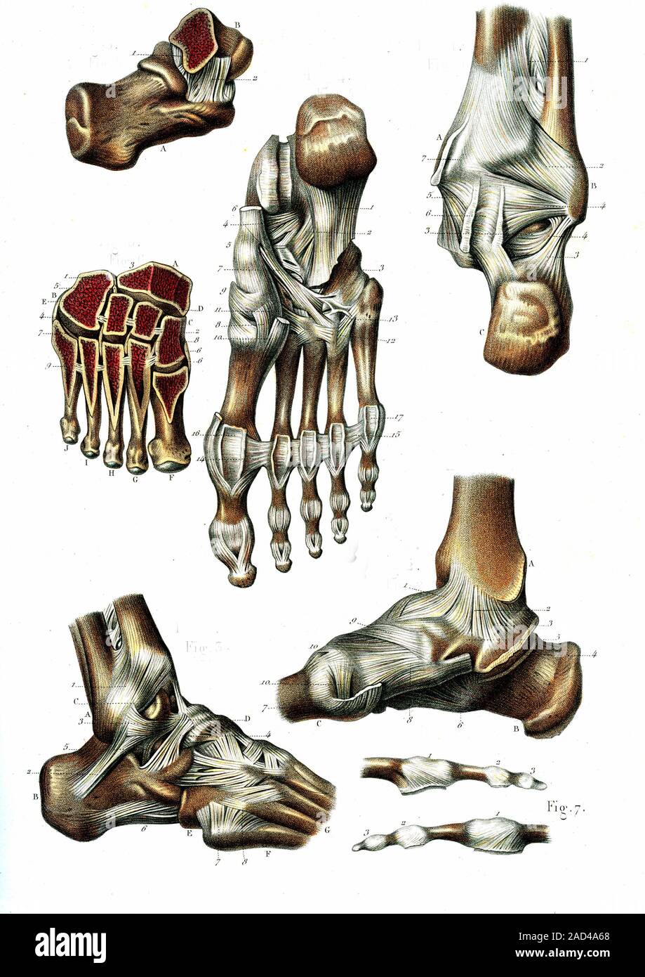 Foot anatomy. 1866 anatomical illustration showing the tendons (white ...