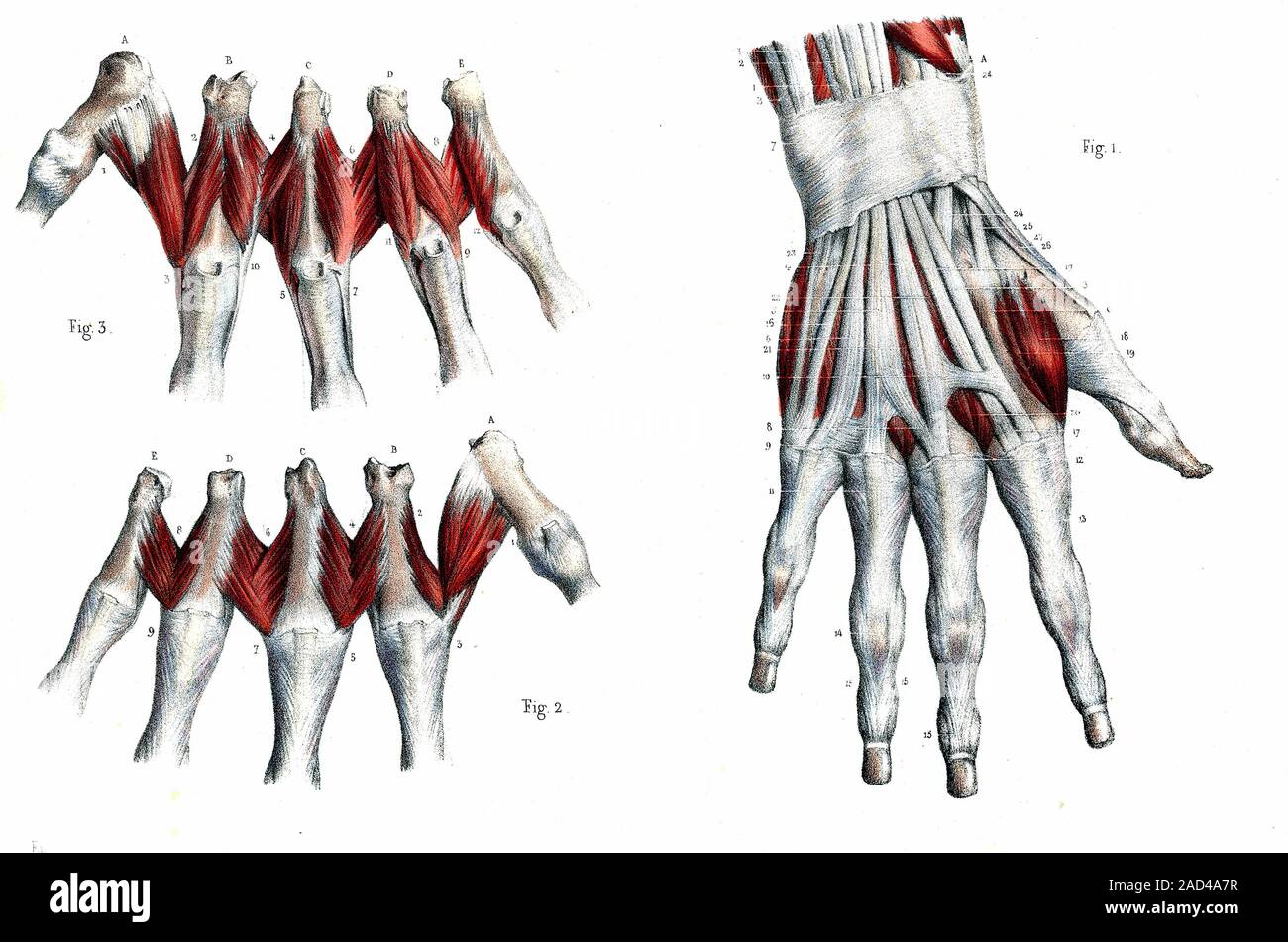 Hand muscles. 1866 anatomical illustration showing the muscles (brown ...