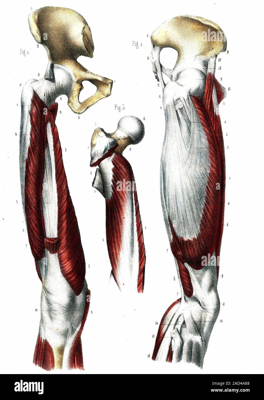 Leg joints. 1866 anatomical illustration showing the muscles (brown ...