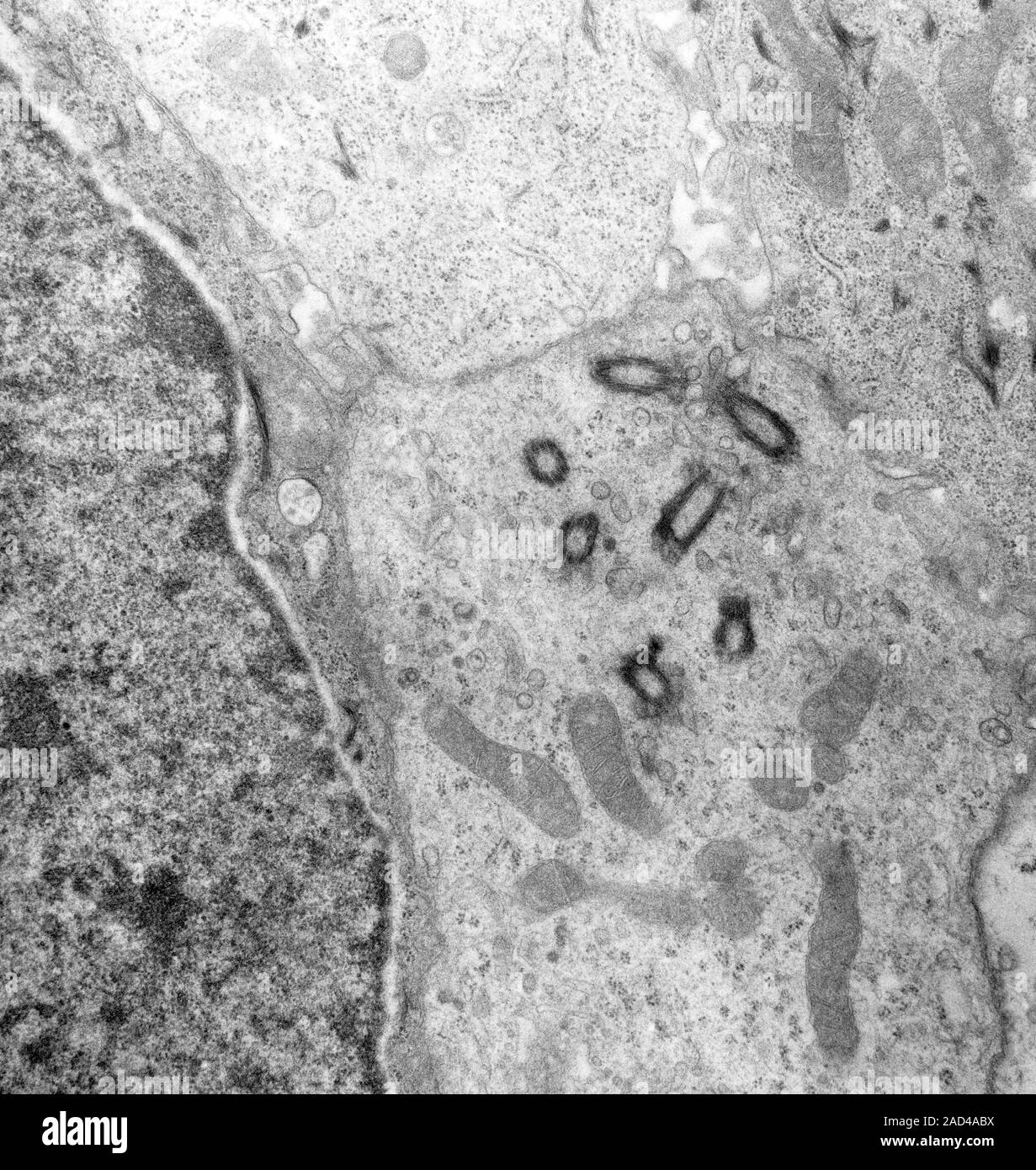 Trachea. Transmission electron micrograph (TEM) of a tangential section ...
