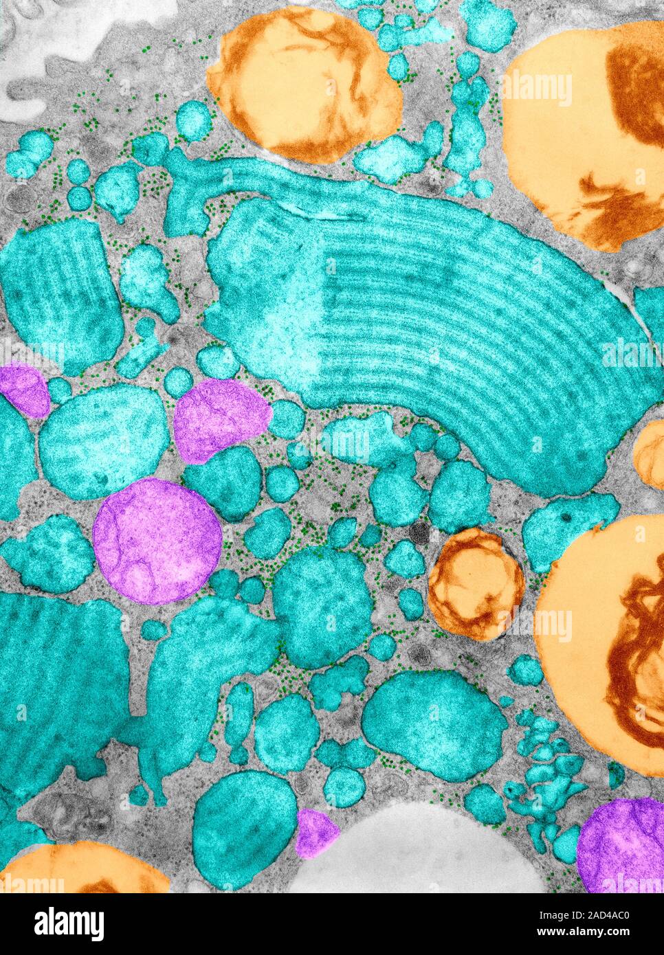 Alveolar cell. Coloured transmission electron micrograph (TEM) of a ...