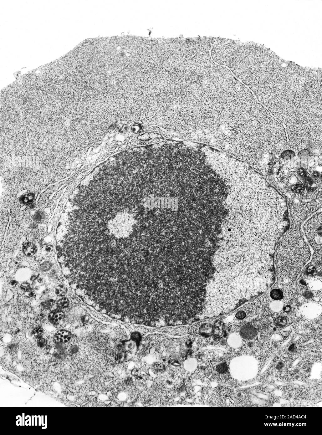 HeLa cell. Transmission electron micrograph (TEM) of a section through ...