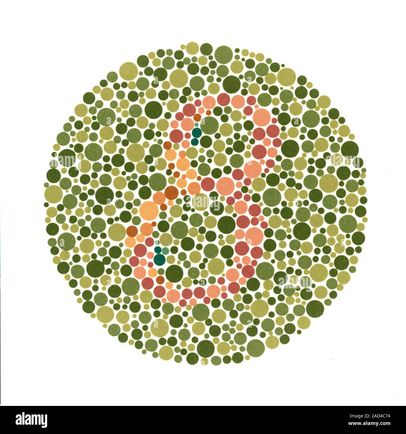 Colour blindness test. Plate 2 of an Ishihara test. Invented by ...