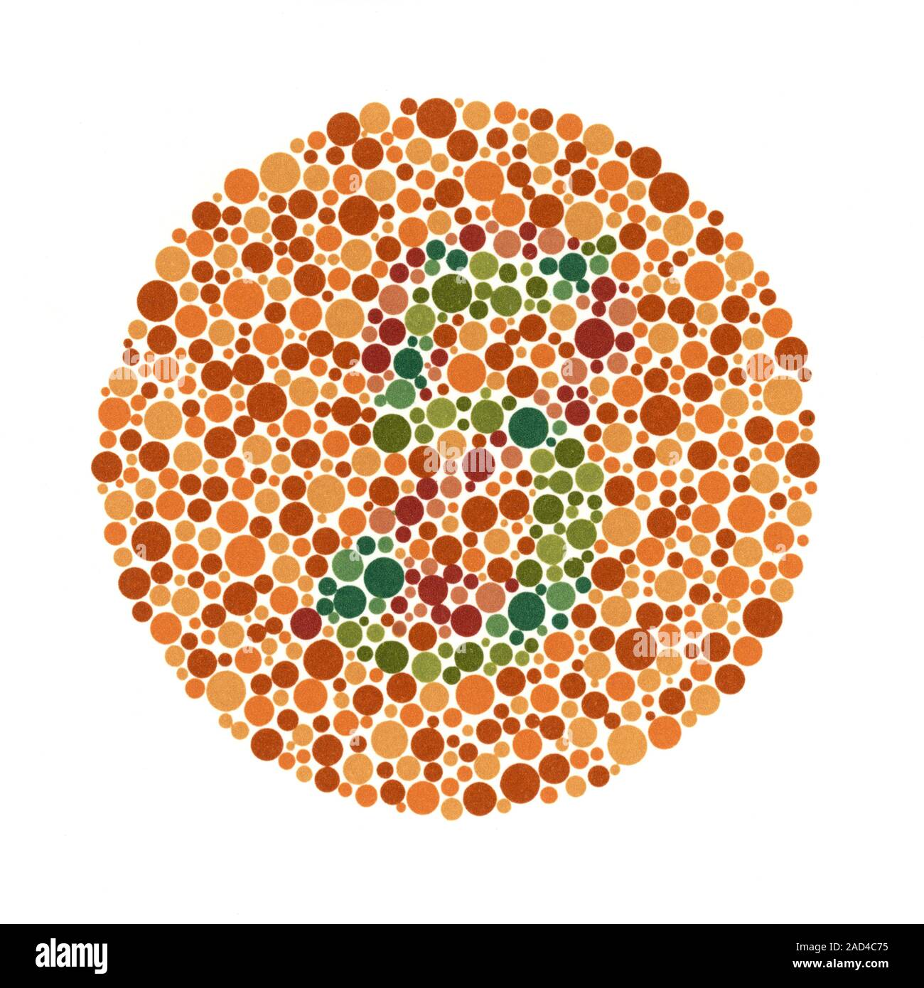 Colour blindness test. Plate 3 of an Ishihara test. Invented by ...