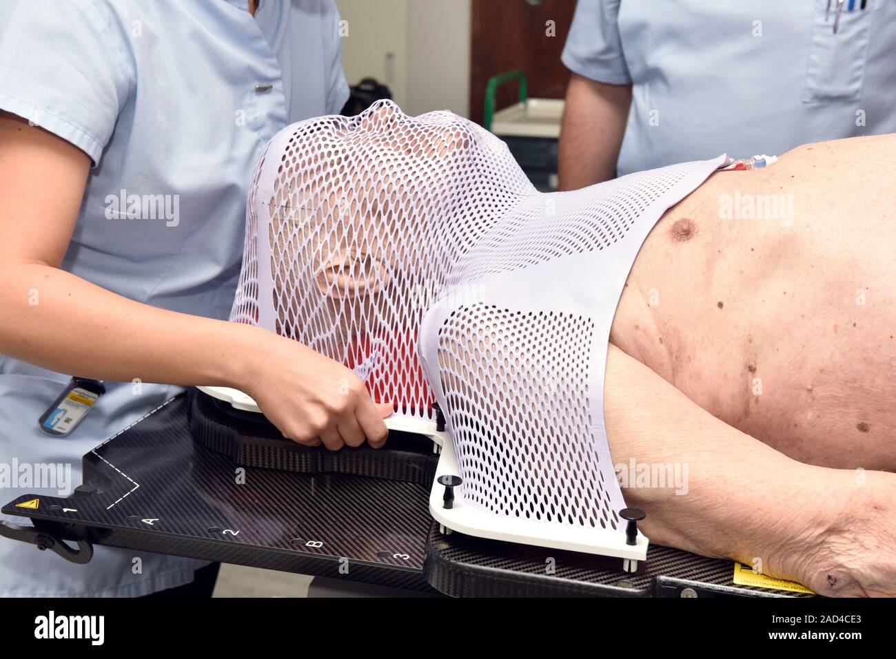 Radiotherapy. 77-year-old male patient being prepared for palliative ...