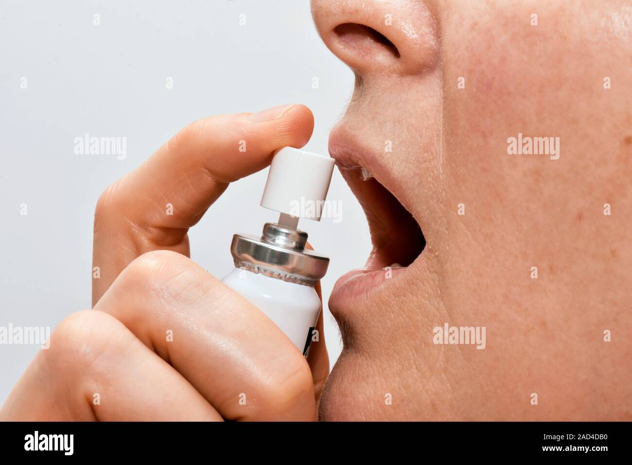 Glyceryl trinitrate heart drug. A patient using a spray bottle to take ...