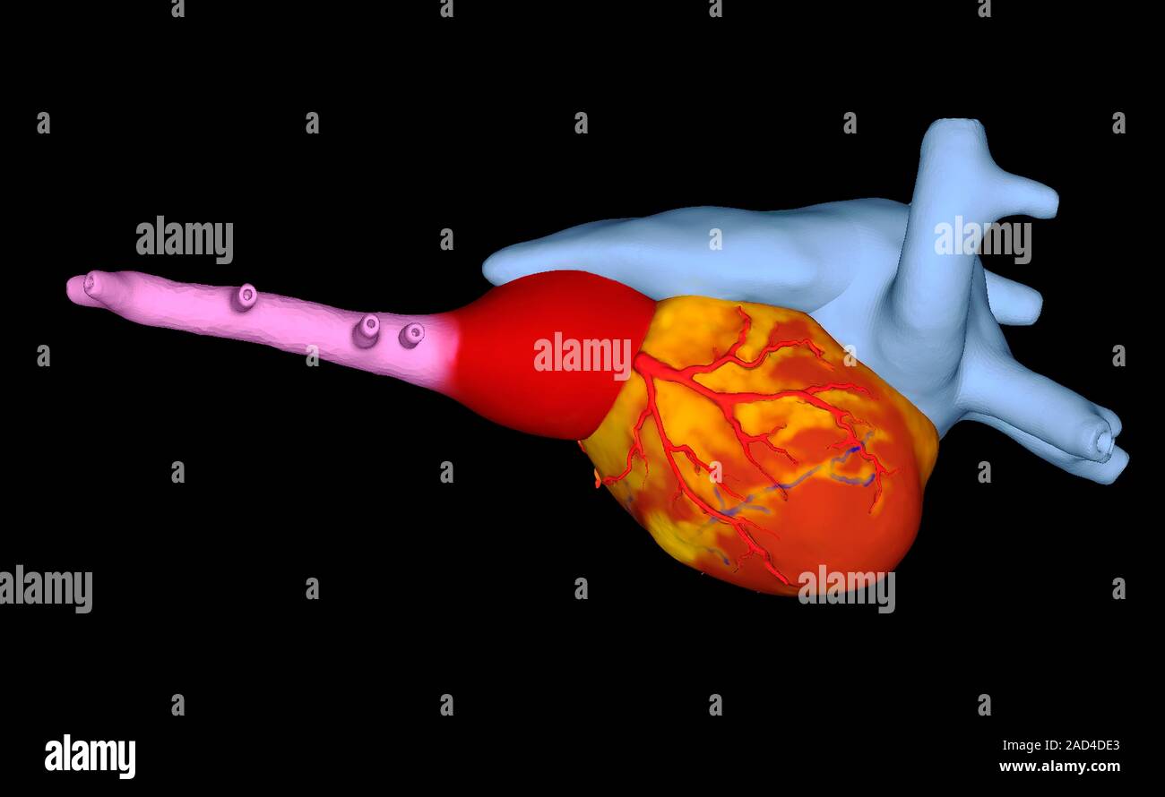 Zebrafish heart. Digitally enhanced 3D micro-computed tomography (CT ...
