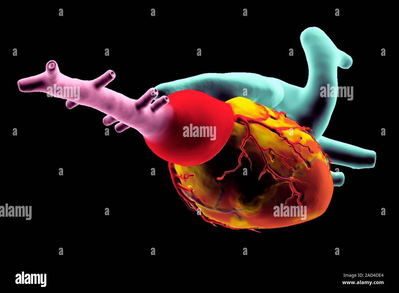 Zebrafish heart. Digitally enhanced 3D micro-computed tomography (CT ...