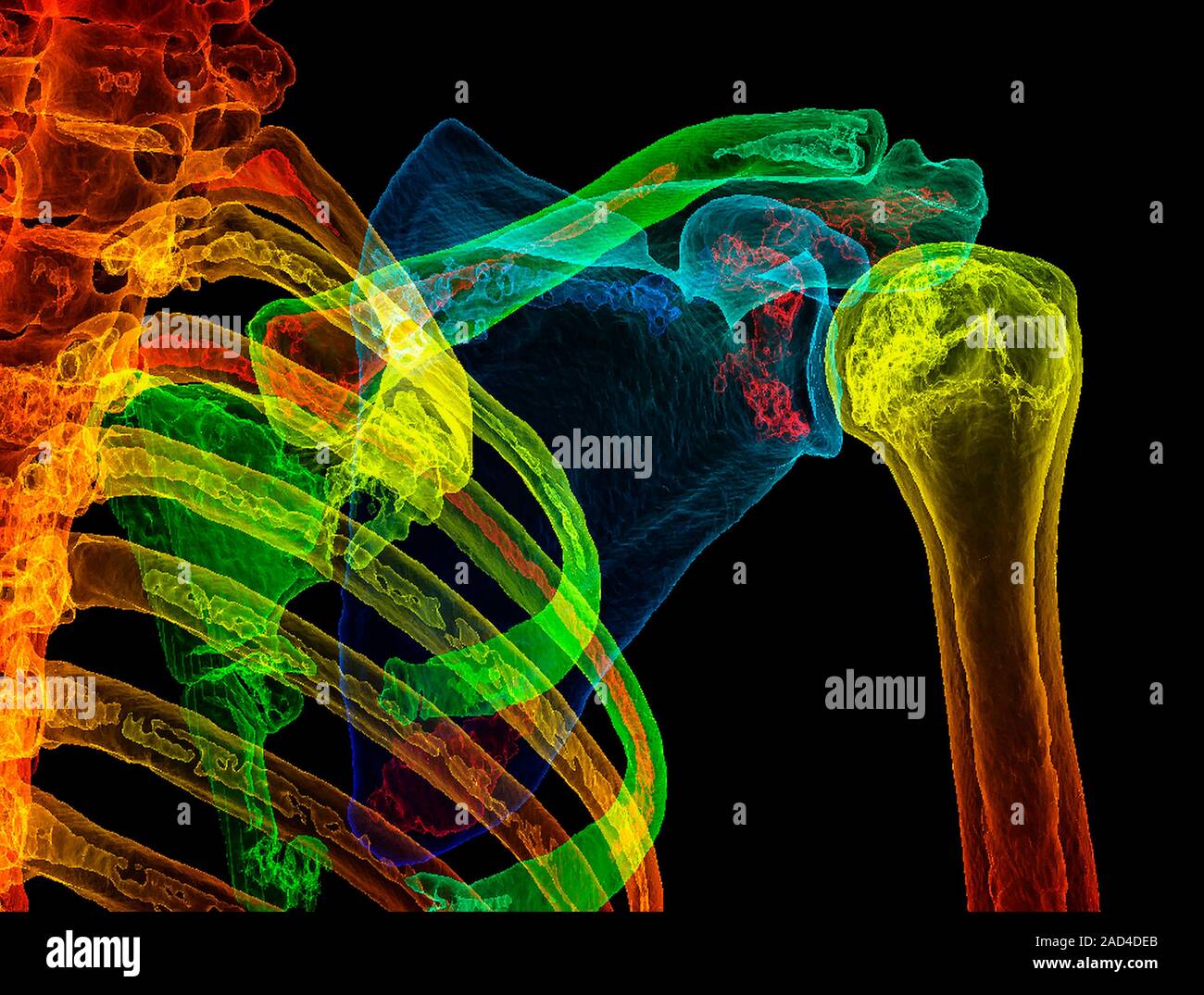 Normal shoulder joint. Coloured 3D computed tomography (CT) scan of the ...
