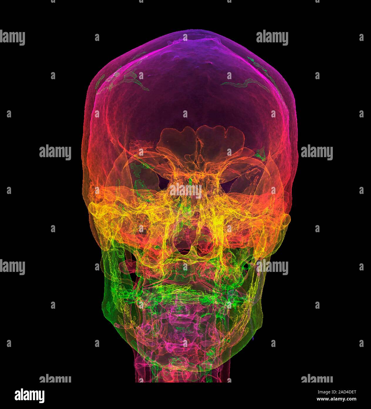 Normal skull. Coloured 3D computed tomography (CT) scan of a normal human skull Stock Photo - Alamy