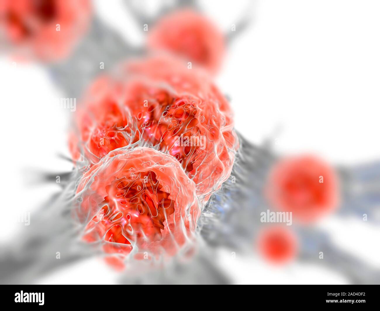 Cancer cell. Computer illustration of cancer cells, showing the ...