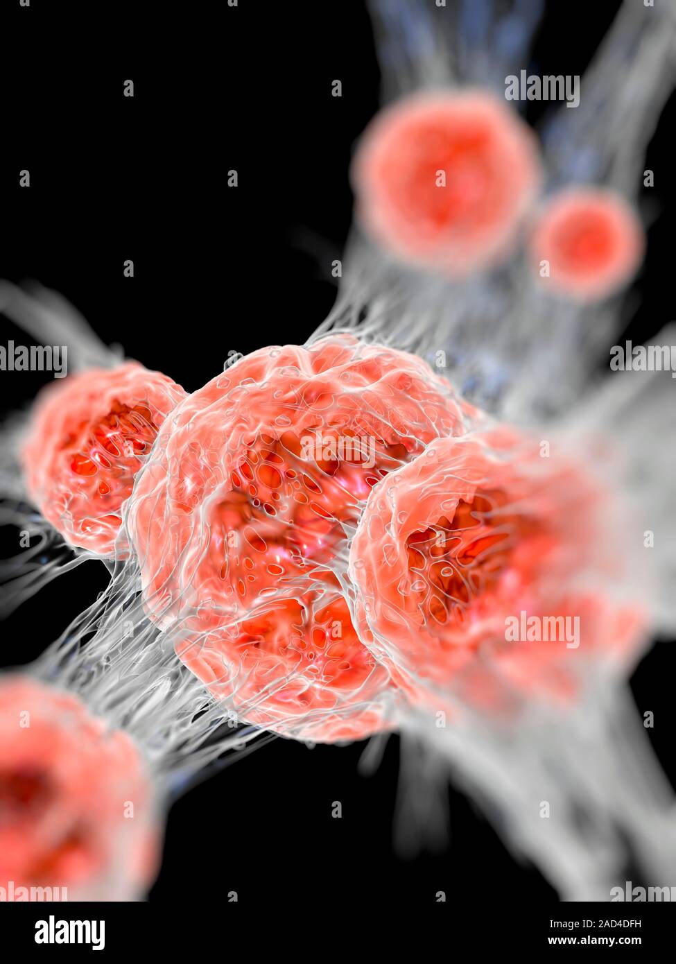 Cancer cell. Computer illustration of cancer cells, showing the ...