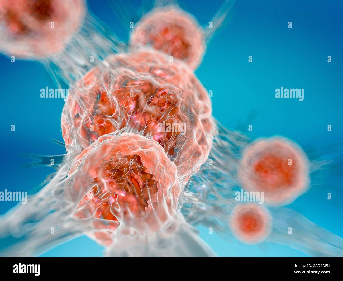 Cancer cell. Computer illustration of cancer cells, showing the ...