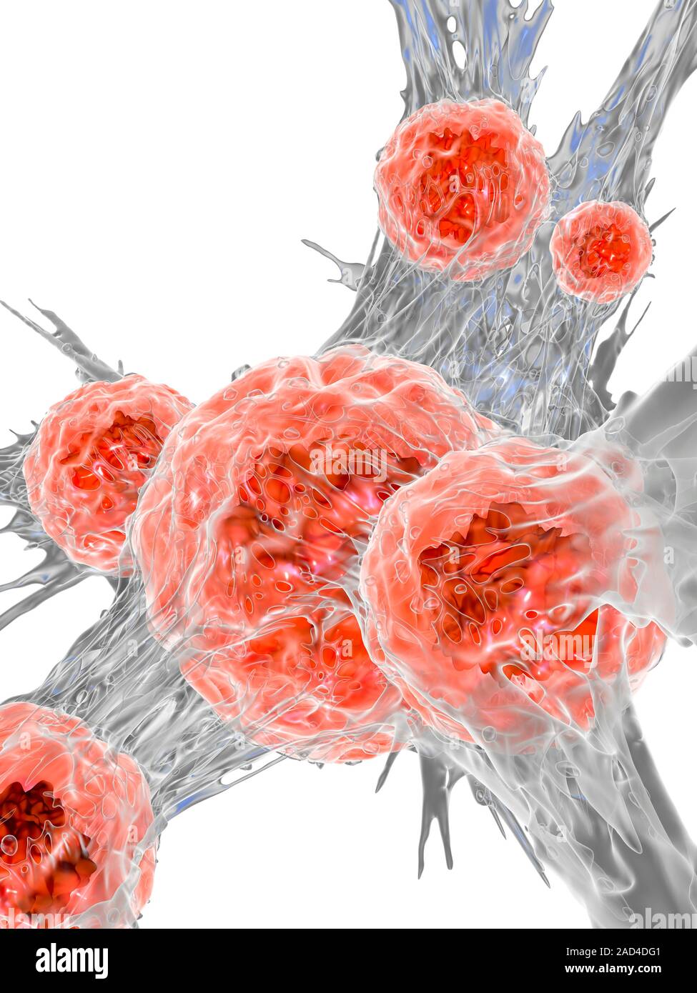 Cancer cell. Computer illustration of cancer cells, showing the ...