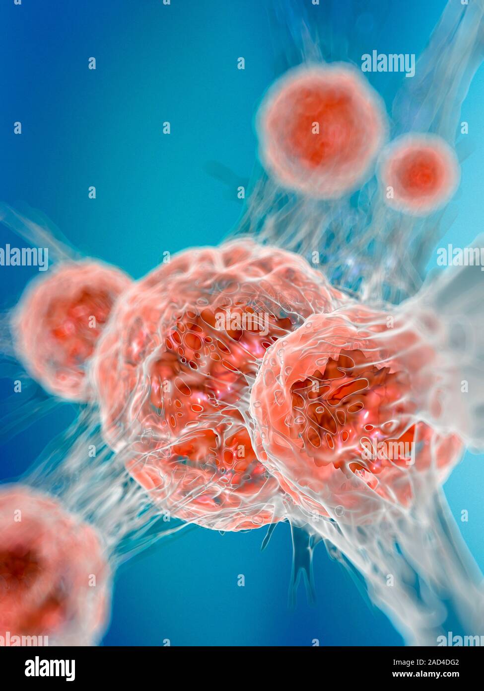 Cancer cell. Computer illustration of cancer cells, showing the ...