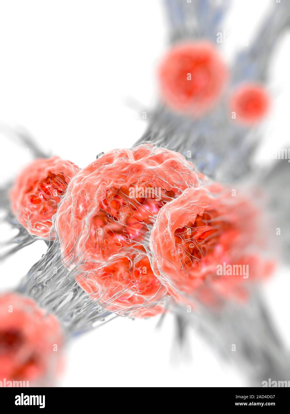 Cancer cell. Computer illustration of cancer cells, showing the ...
