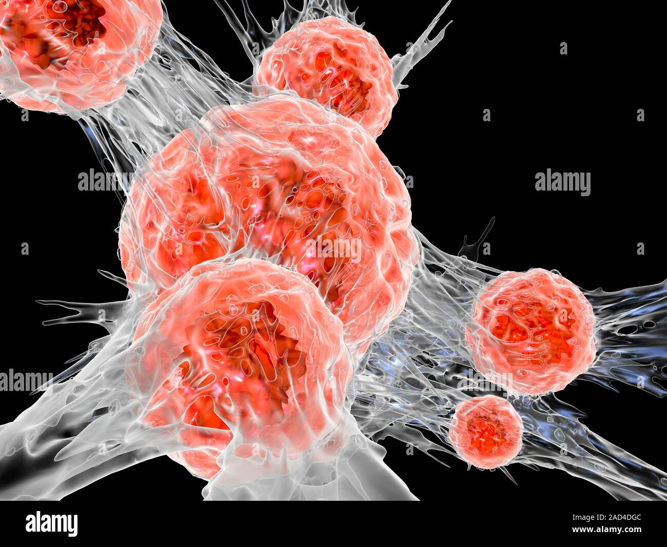 Cancer cell. Computer illustration of cancer cells, showing the ...