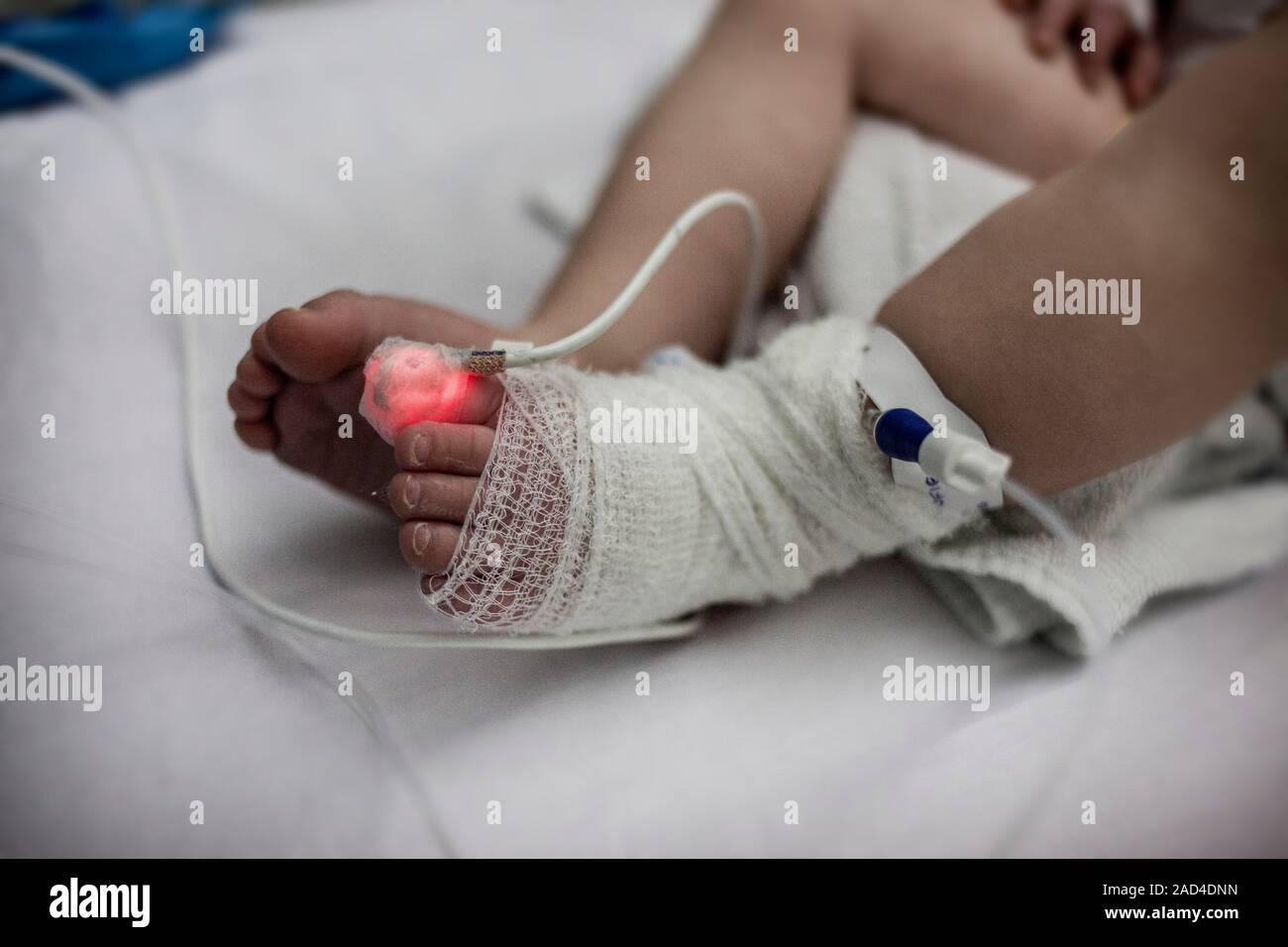 Paediatric pulse oximeter. Close-up of the exposed light-emitting ...