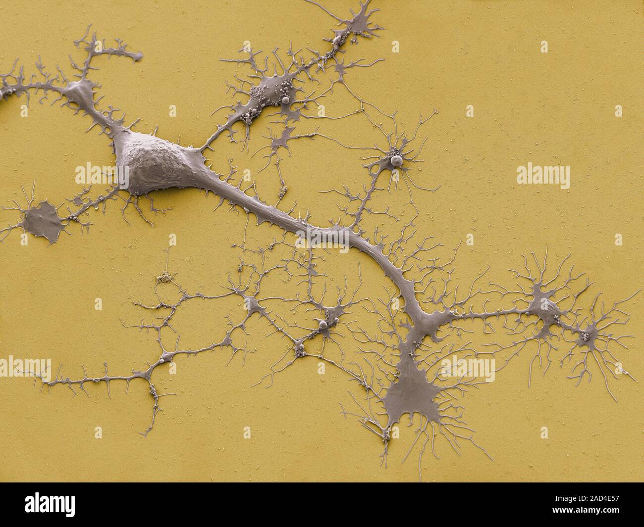 Stem cell-derived neuron. Coloured scanning electron micrograph (SEM ...